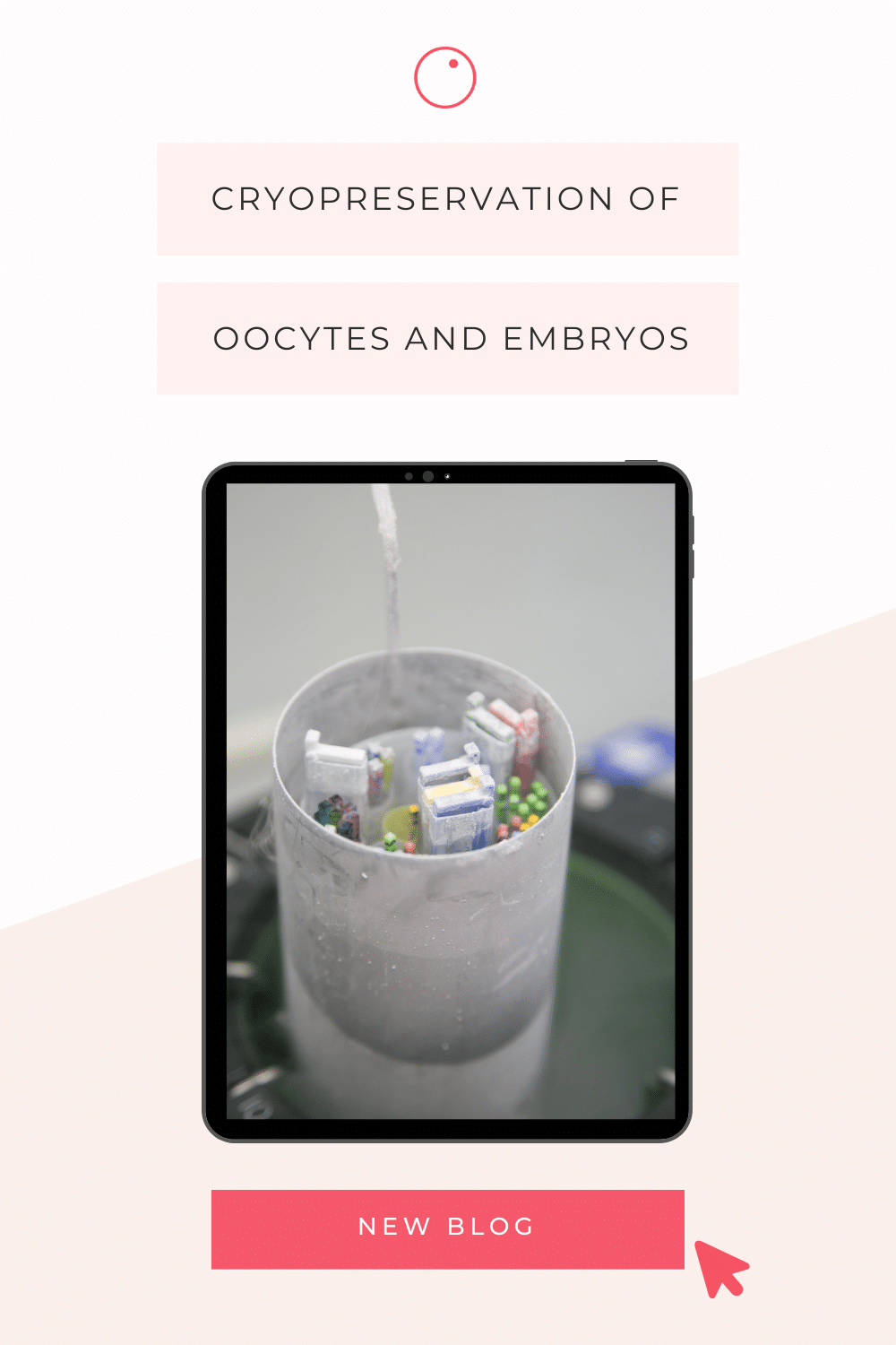 Cryopreservation of Oocytes and Embryos: A Breakthrough in Fertility ...