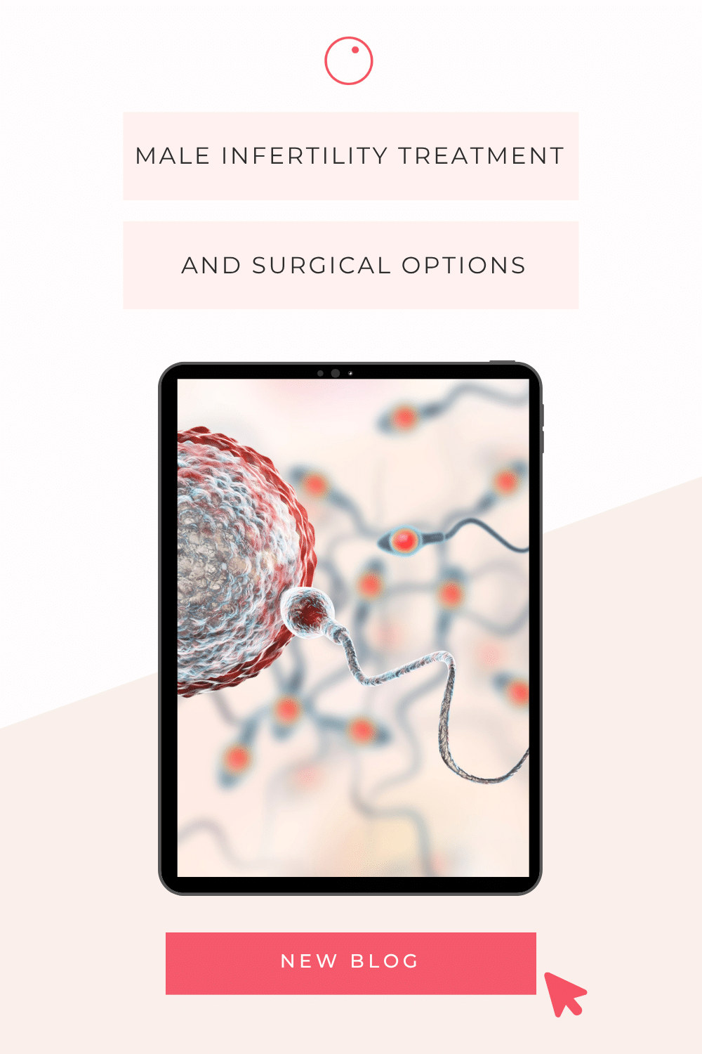 What Are Male infertility treatment and Surgical Options?